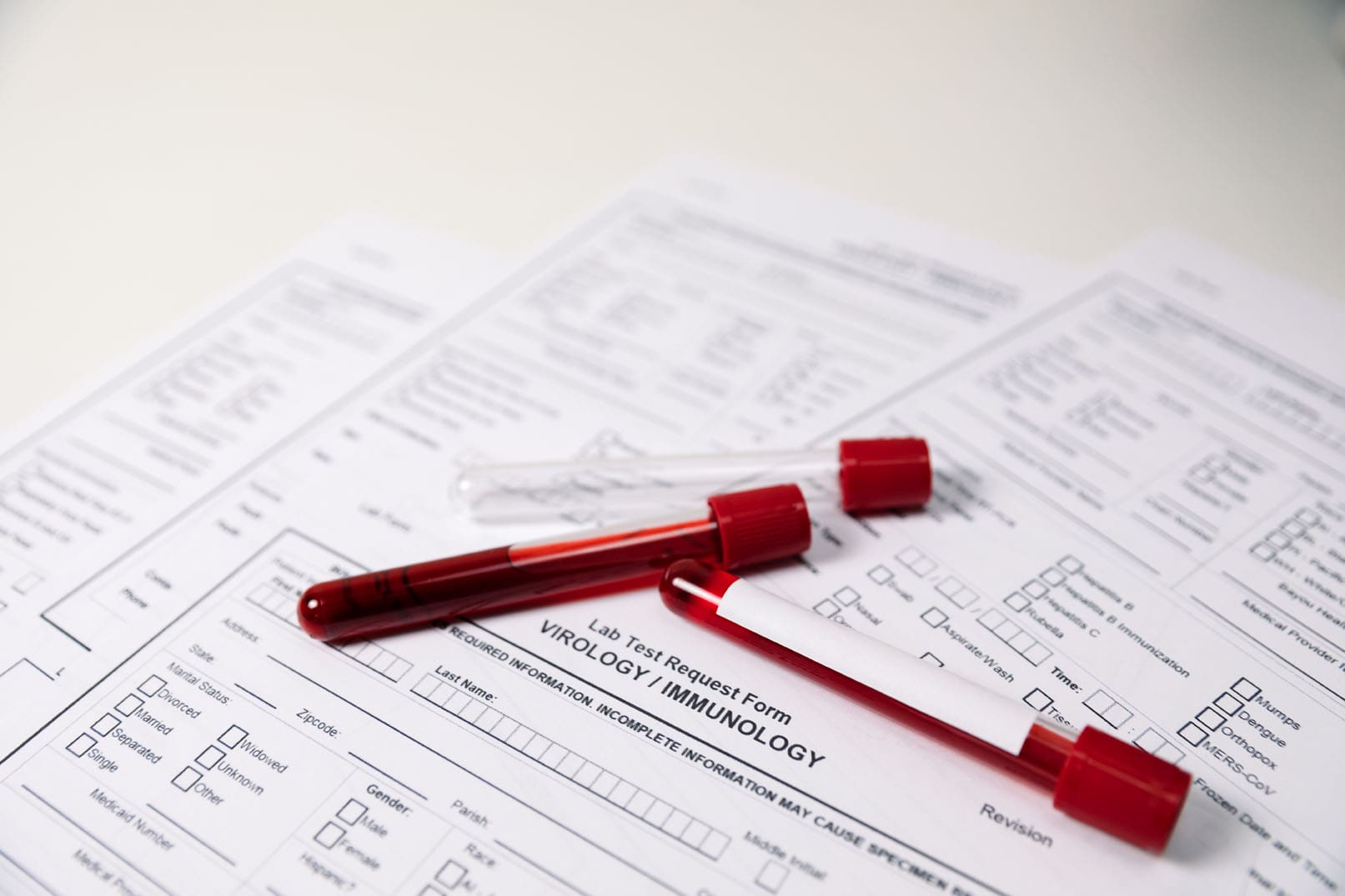 Understanding Blood Tests for Diagnosing Back Pain - El Paso, TX Health ...